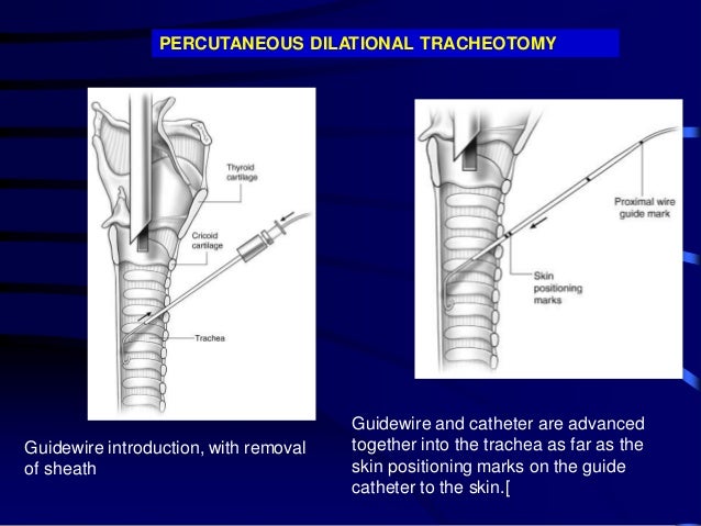 Tracheostomy:When to perform and How to manage?