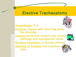 Tracheostomy | PPT