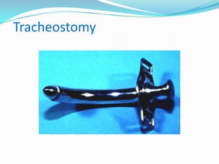 Tracheostomy | PPT