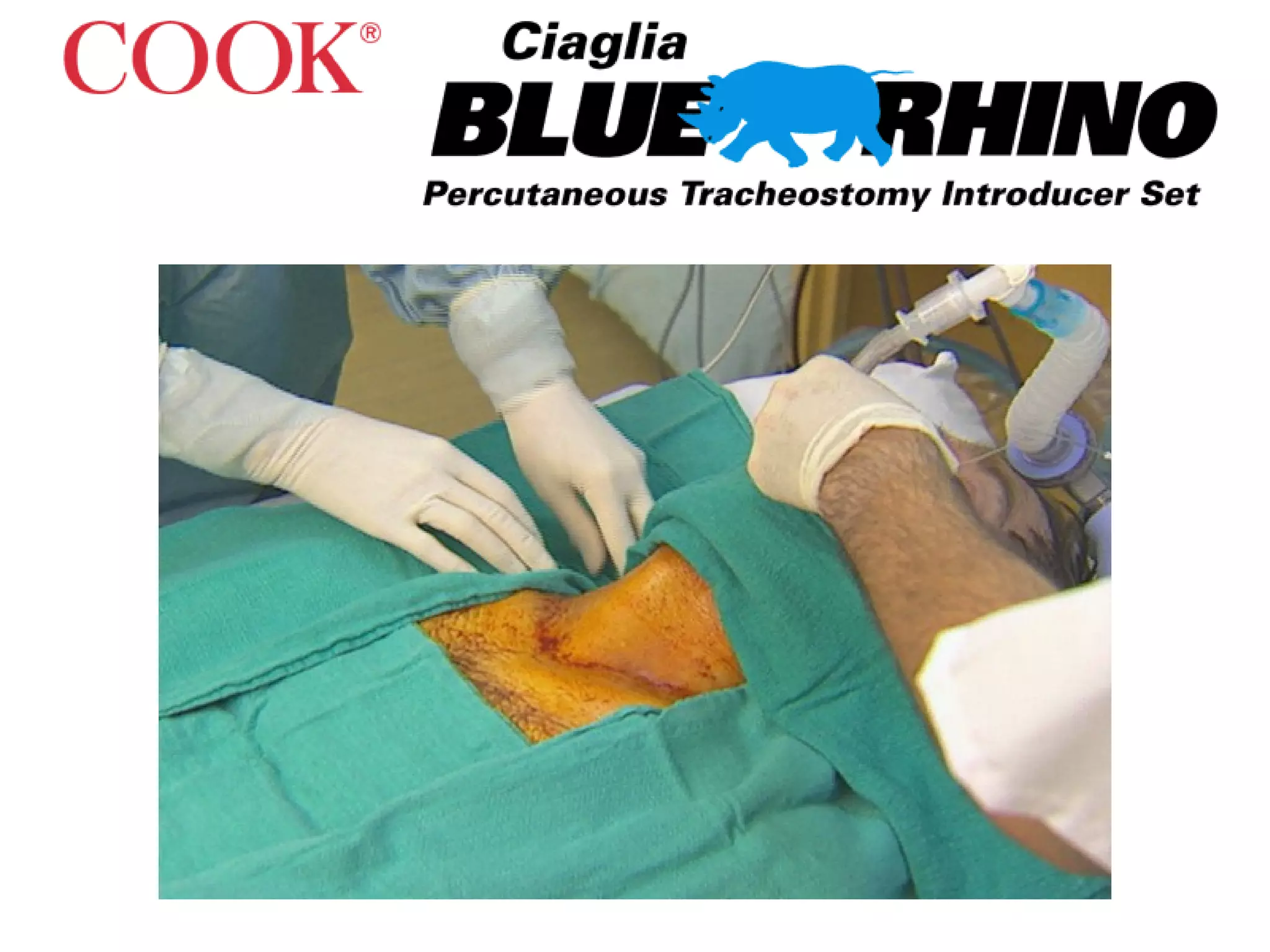 Percutaneous Tracheostomy | PPT