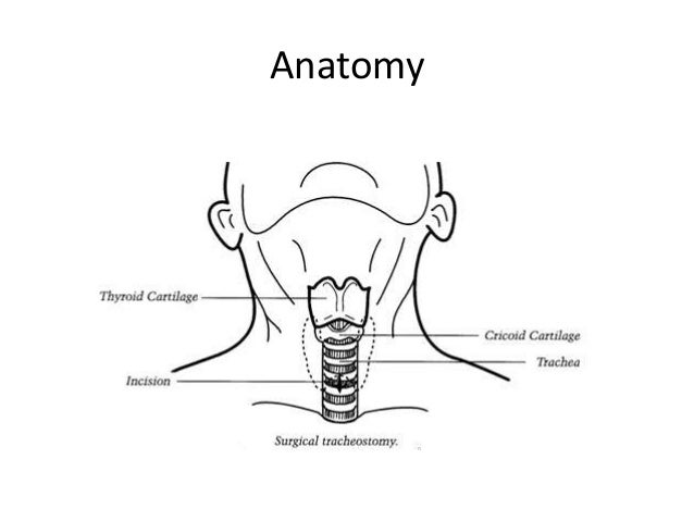 Tracheostomy