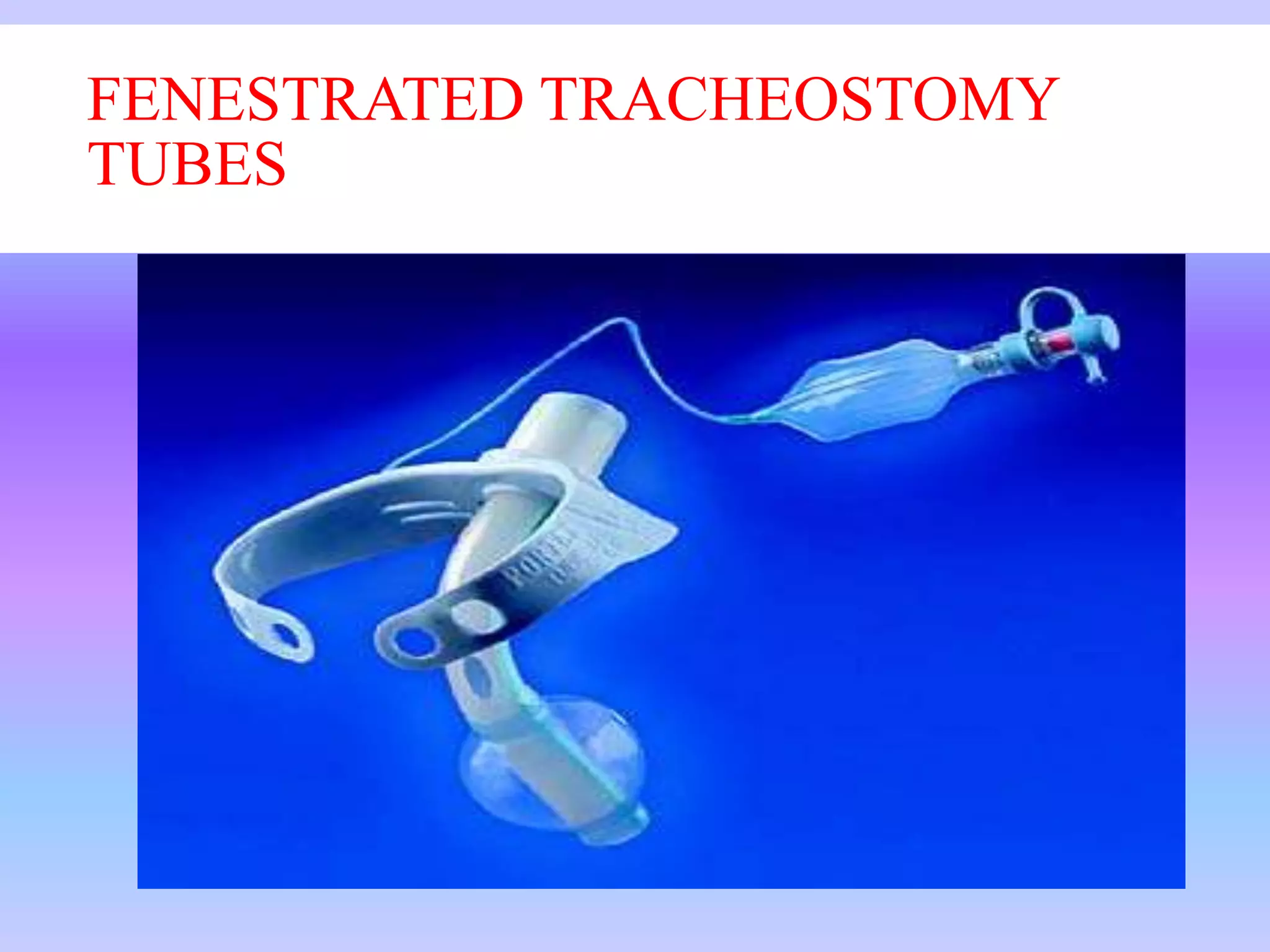 Tracheostomy | PPTX