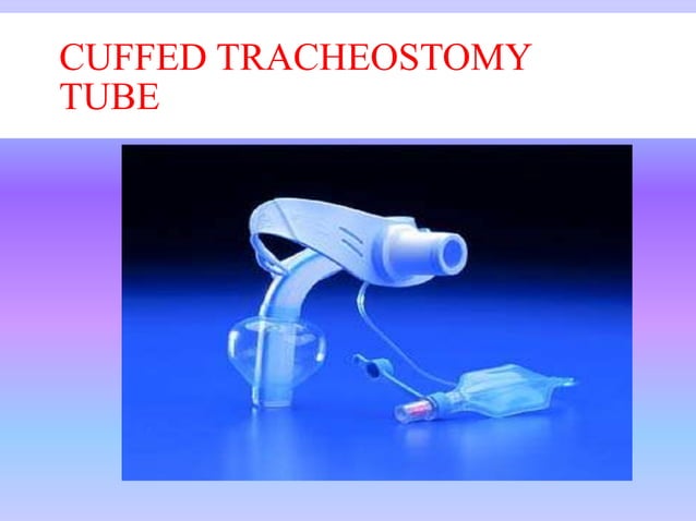 Tracheostomy | PPTX