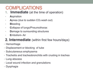 Tracheostomy | PPTX