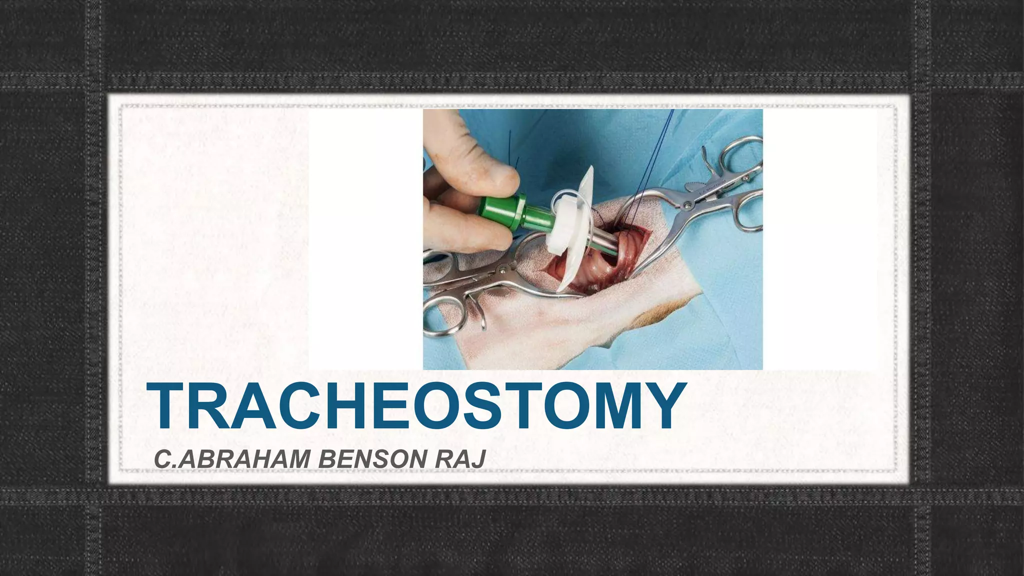 Tracheostomy | PPTX | Lung and Respiratory Health | Diseases and Conditions