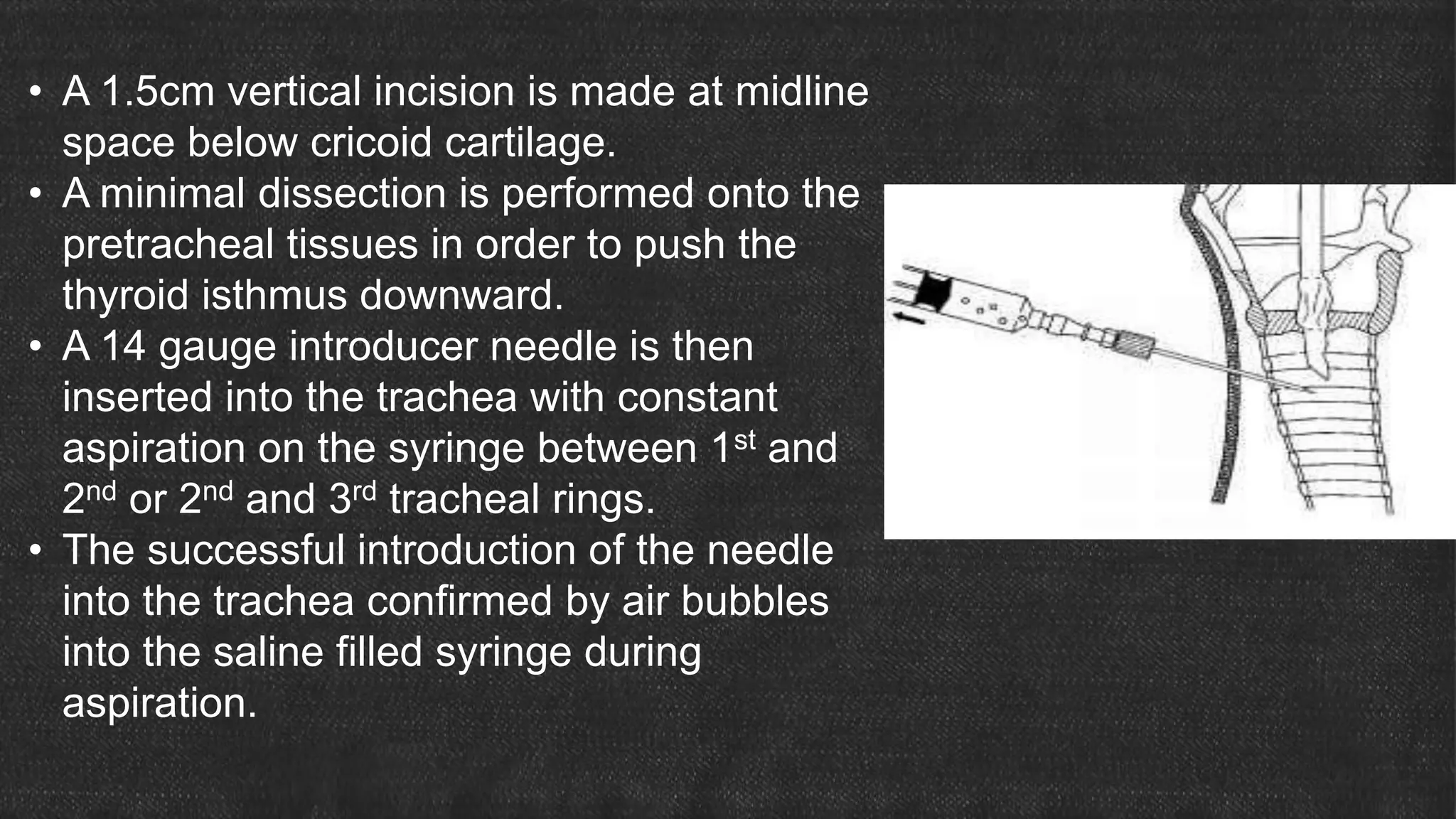 Tracheostomy | PPTX | Lung and Respiratory Health | Diseases and Conditions