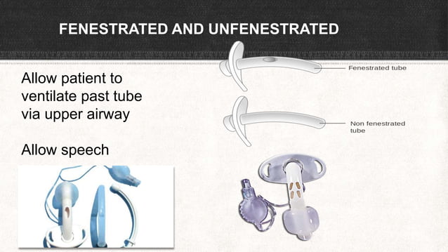 Tracheostomy | PPTX | Lung and Respiratory Health | Diseases and Conditions