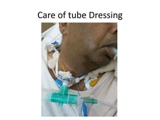 Tracheostomy | PPT