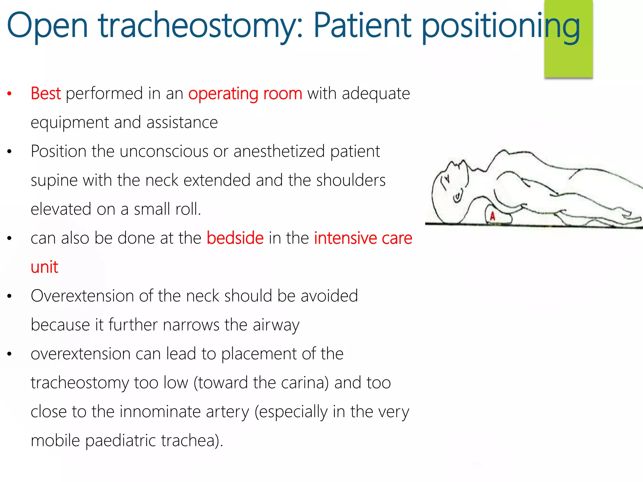 Tracheostomy | PPTX