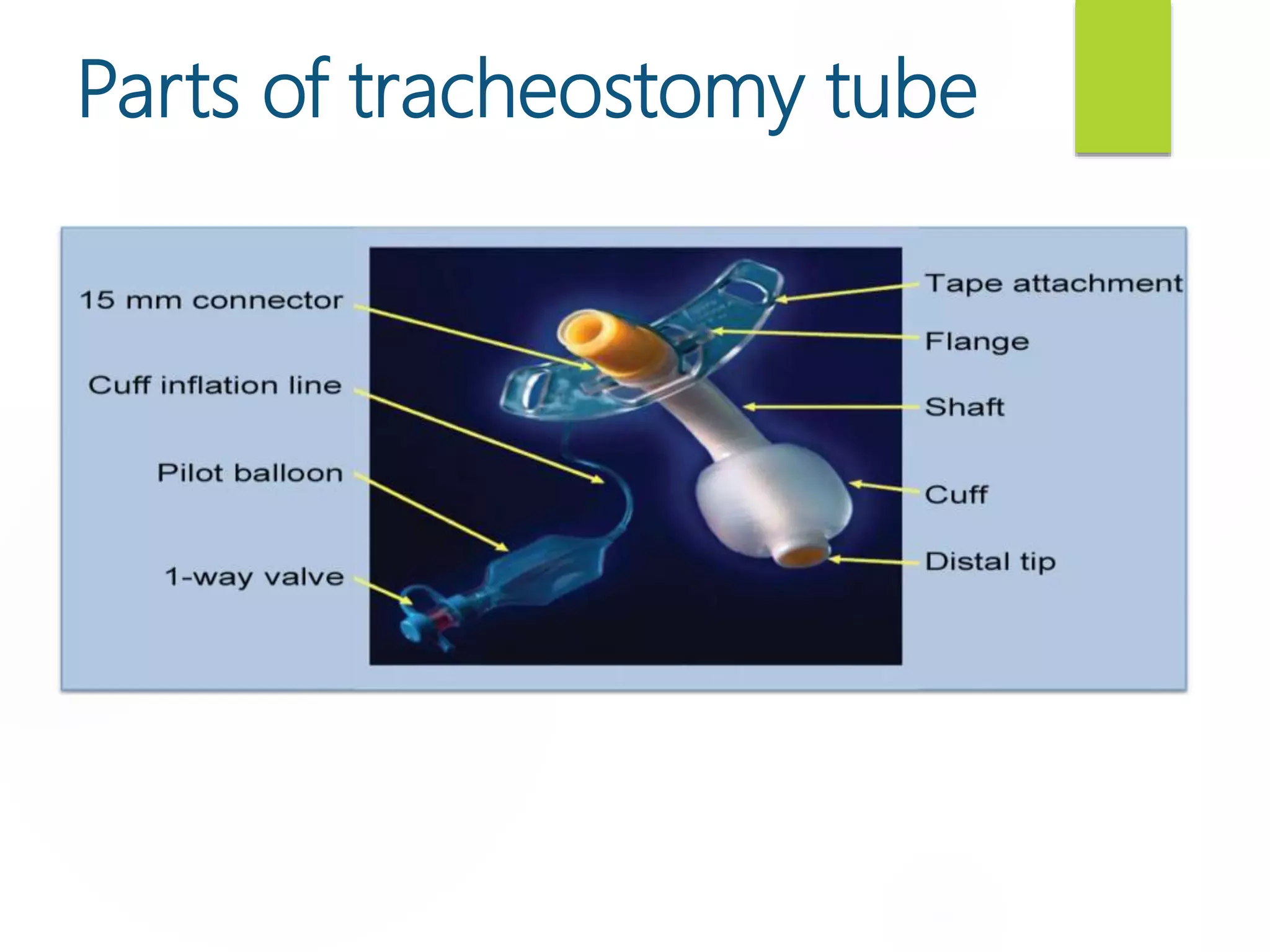 Tracheostomy | PPTX