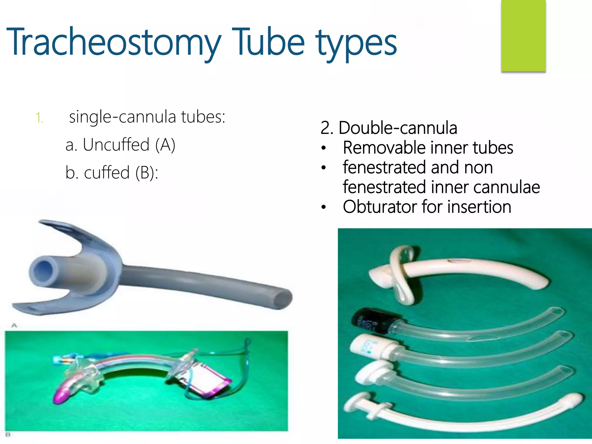 Tracheostomy | PPTX