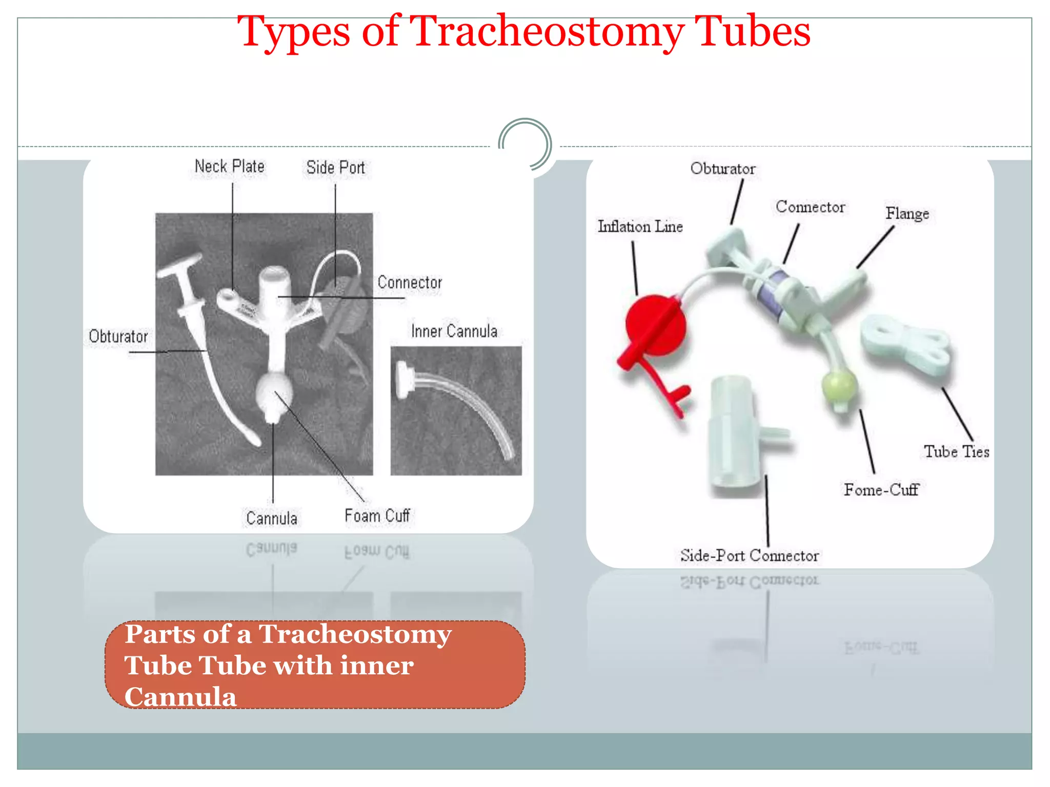 Tracheostomy | PPTX | Ear, Nose and Throat Conditions | Diseases and ...