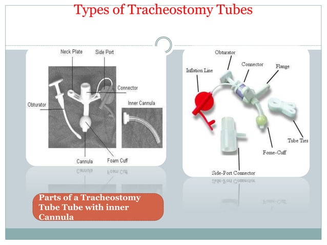 Tracheostomy | PPTX | Ear, Nose and Throat Conditions | Diseases and ...
