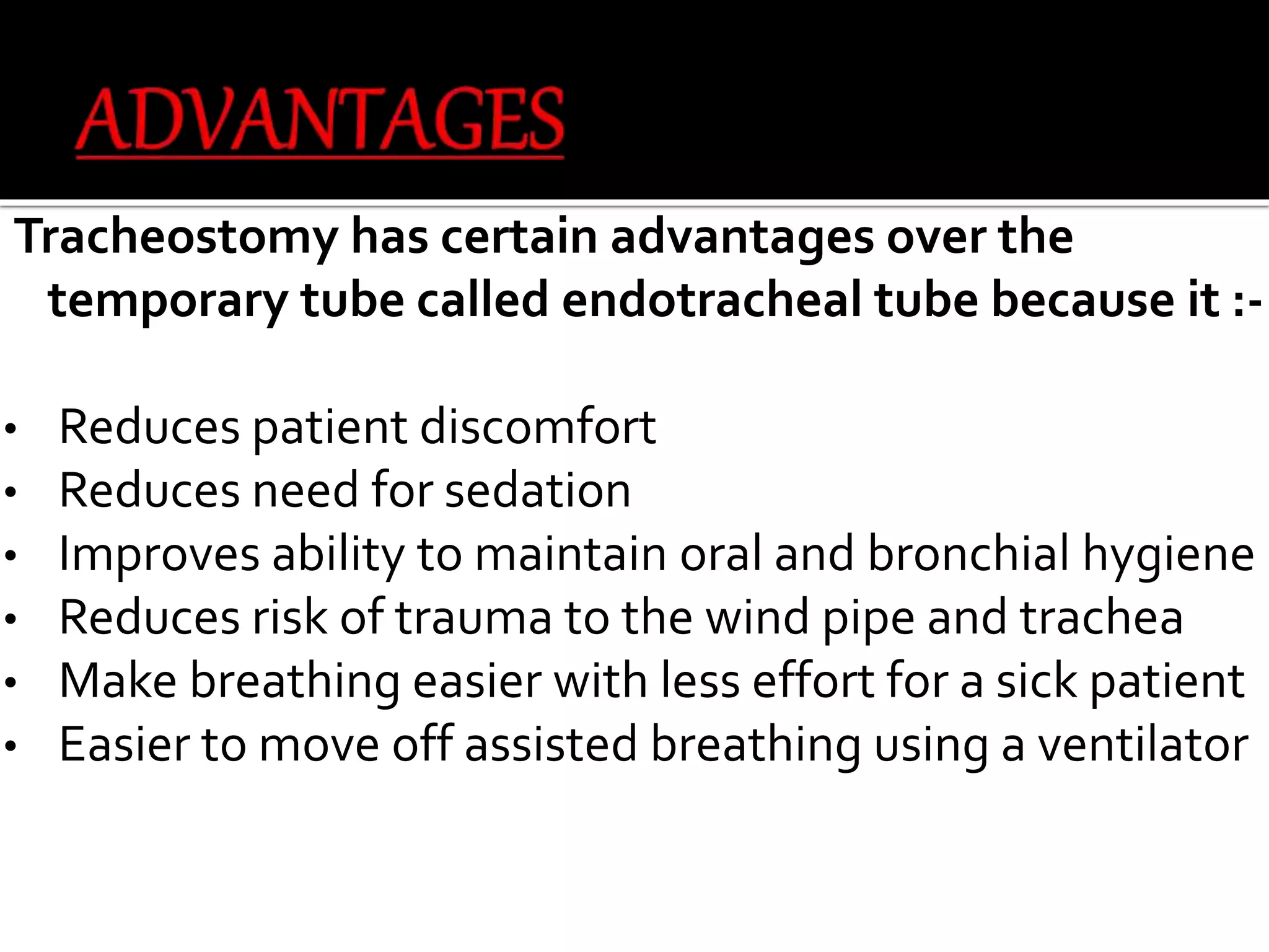 Tracheostomy ( for medical students ) | PPTX