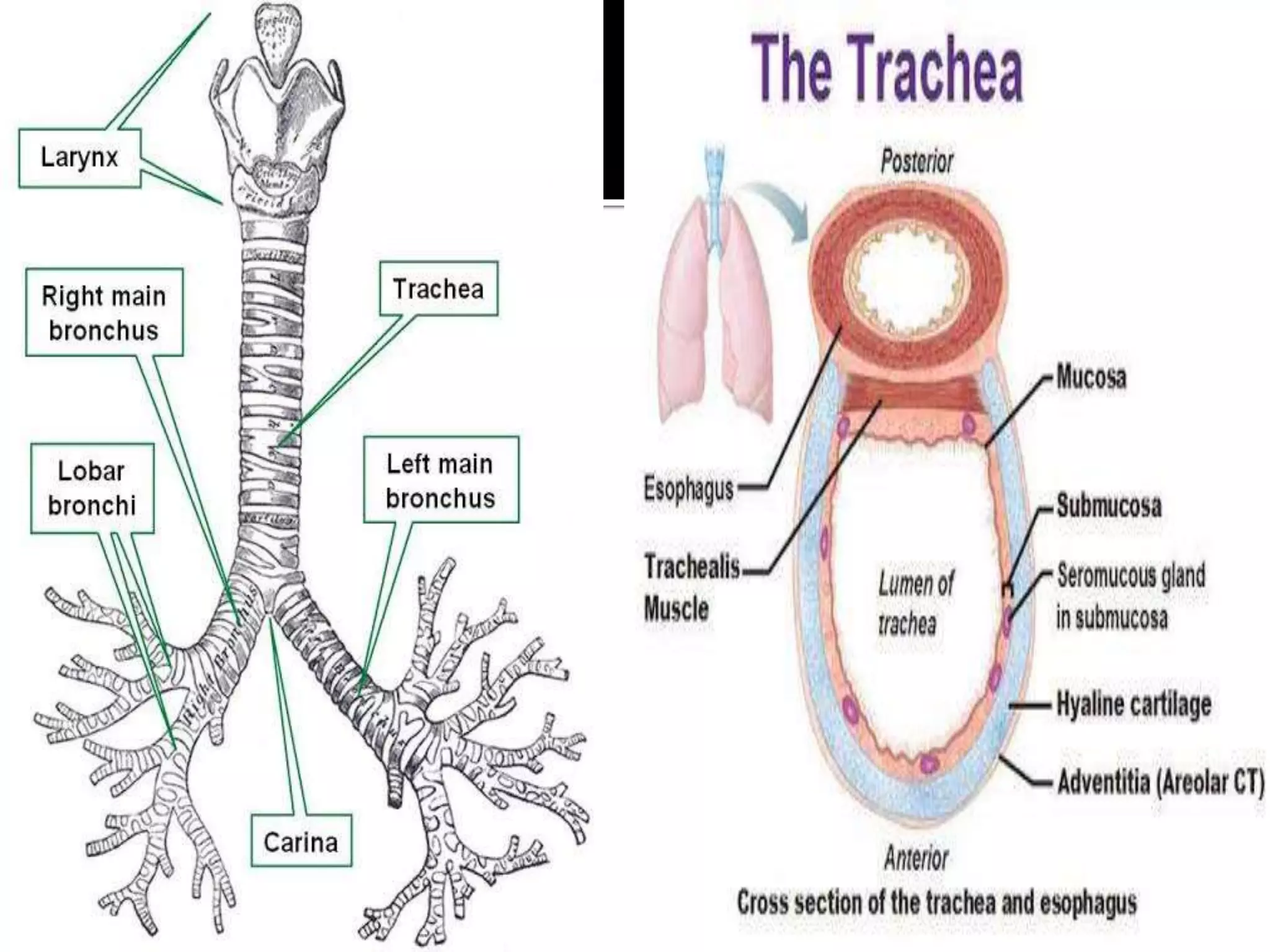 Tracheostomy ( for medical students ) | PPTX