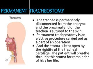 Tracheostomy ( for medical students ) | PPTX