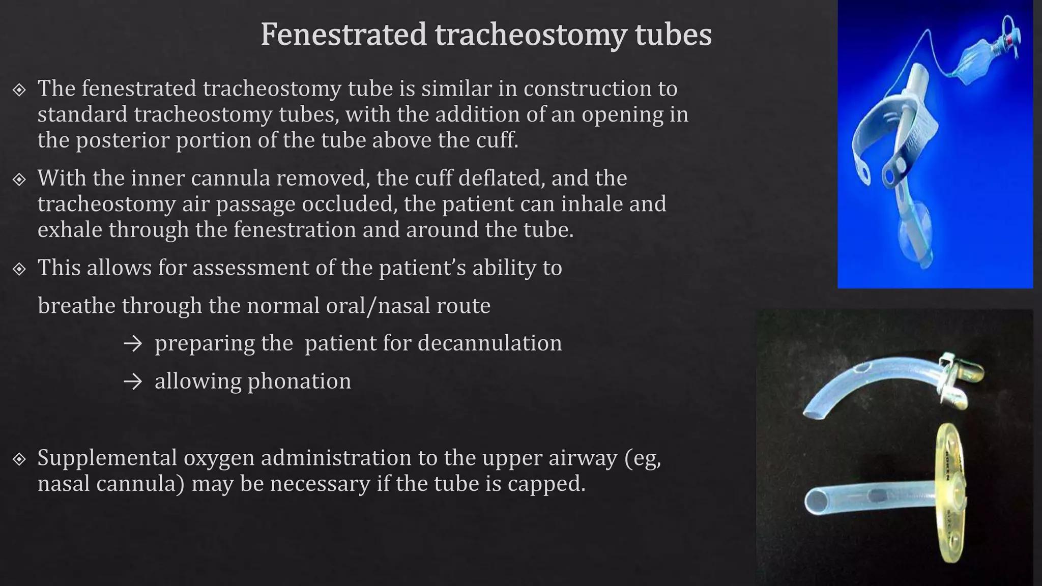 Tracheostomy | PPT