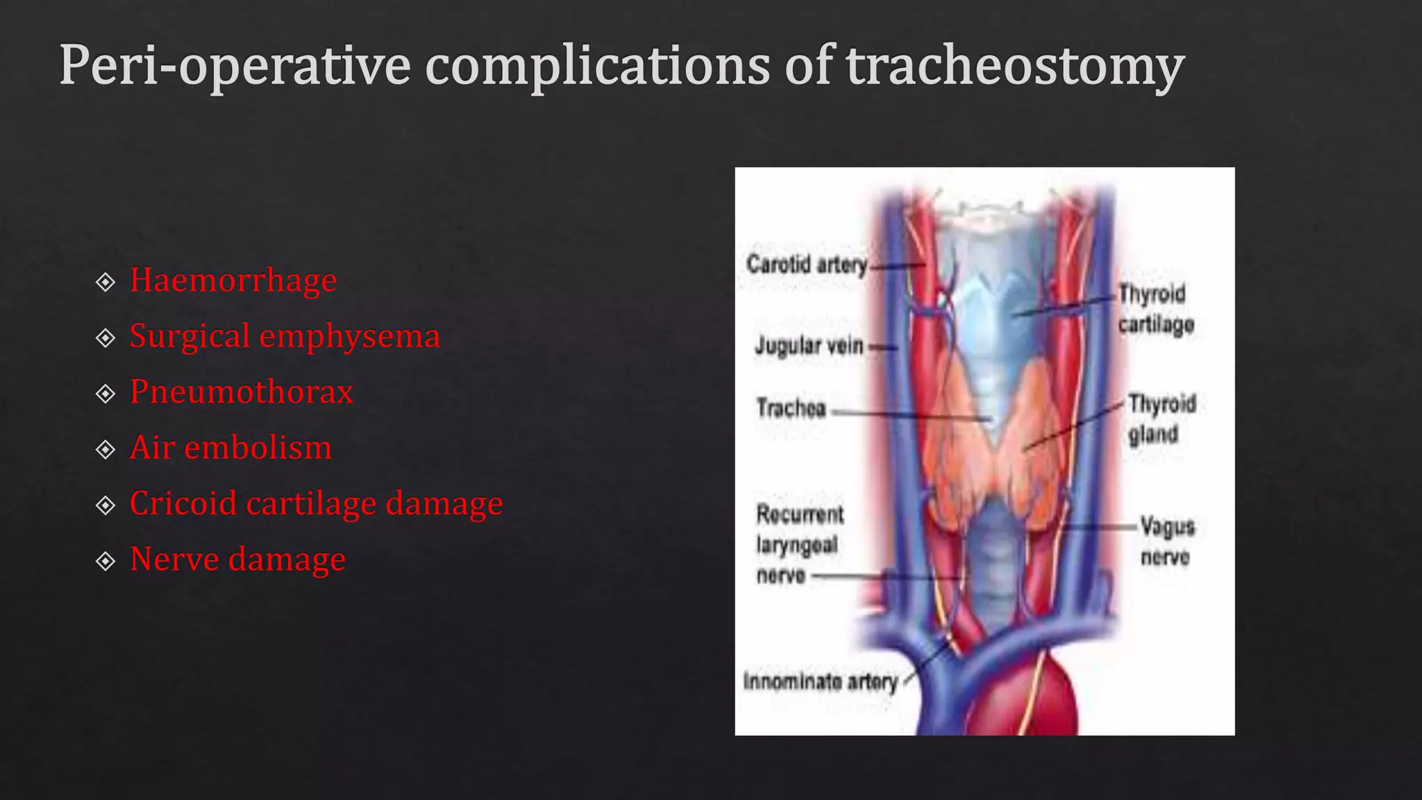 Tracheostomy | PPT