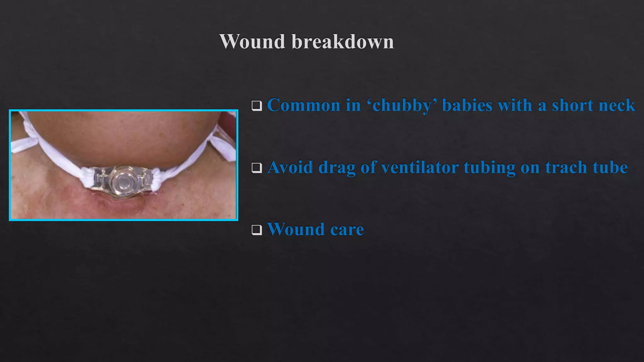 Tracheostomy | PPT
