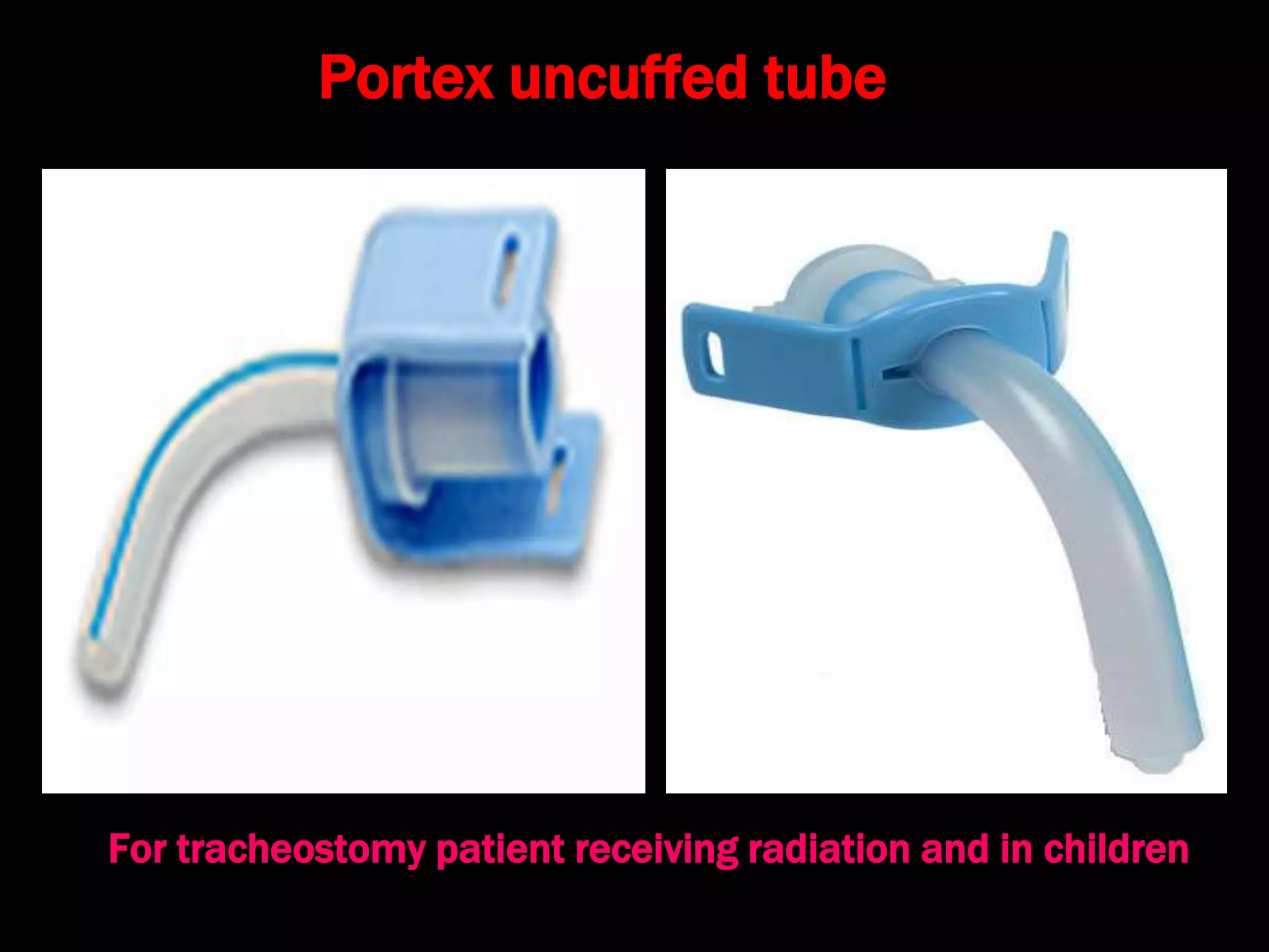 Tracheostomy | PPT