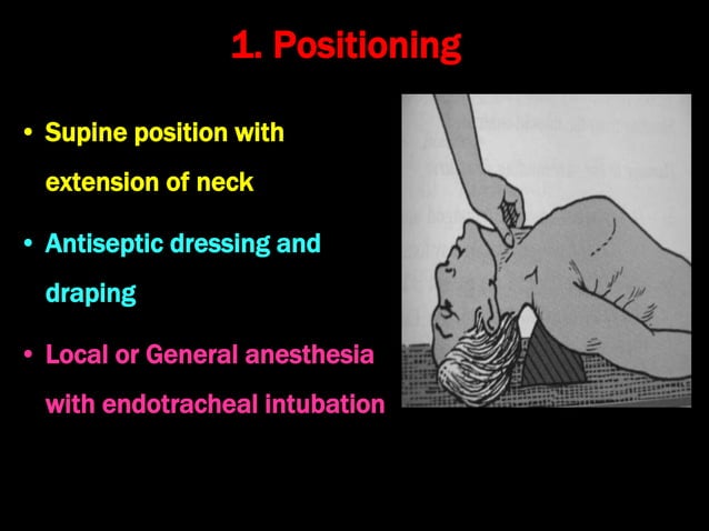 Tracheostomy | PPT