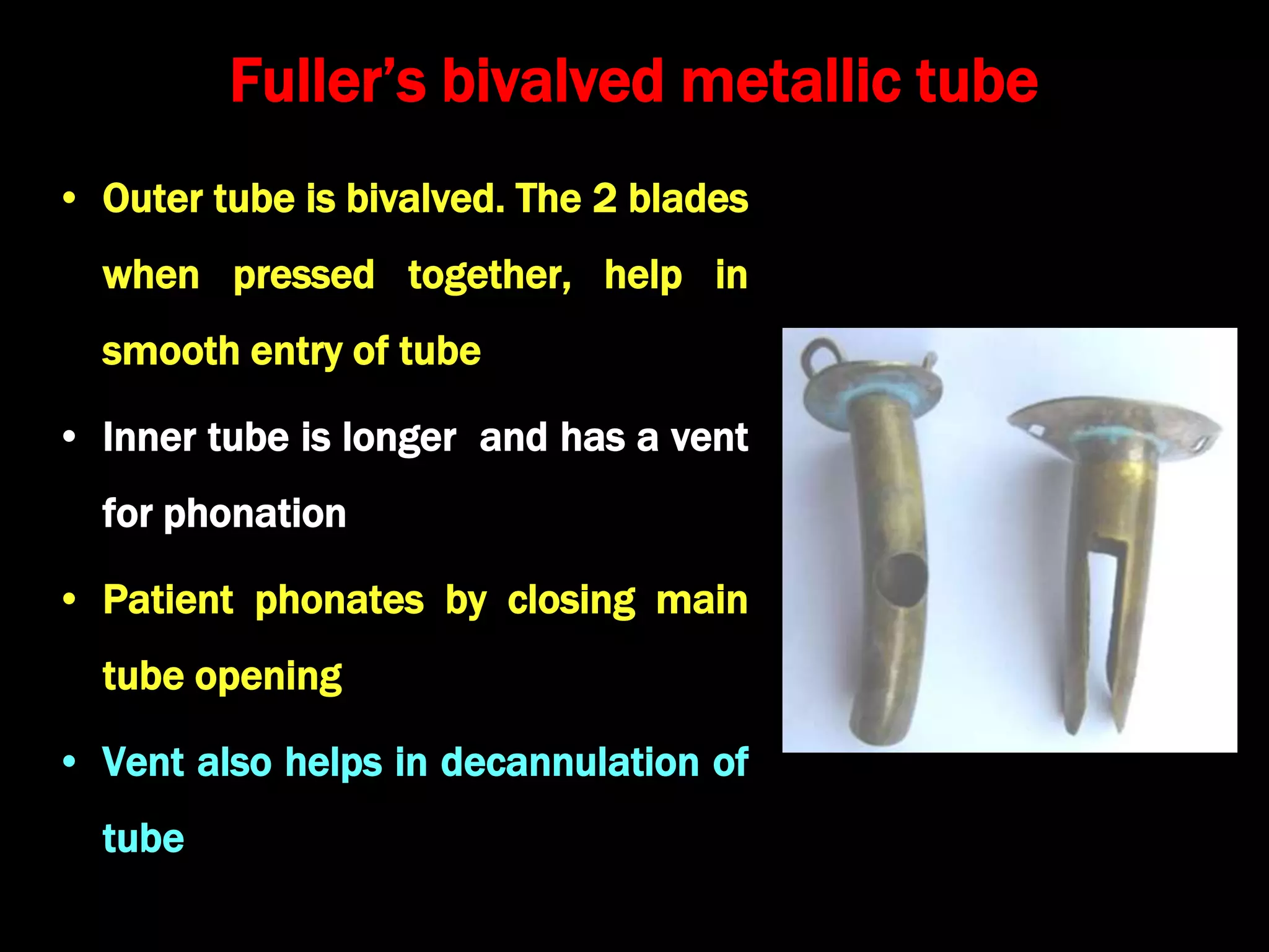 Tracheostomy: History, definition, indications, procedure ...
