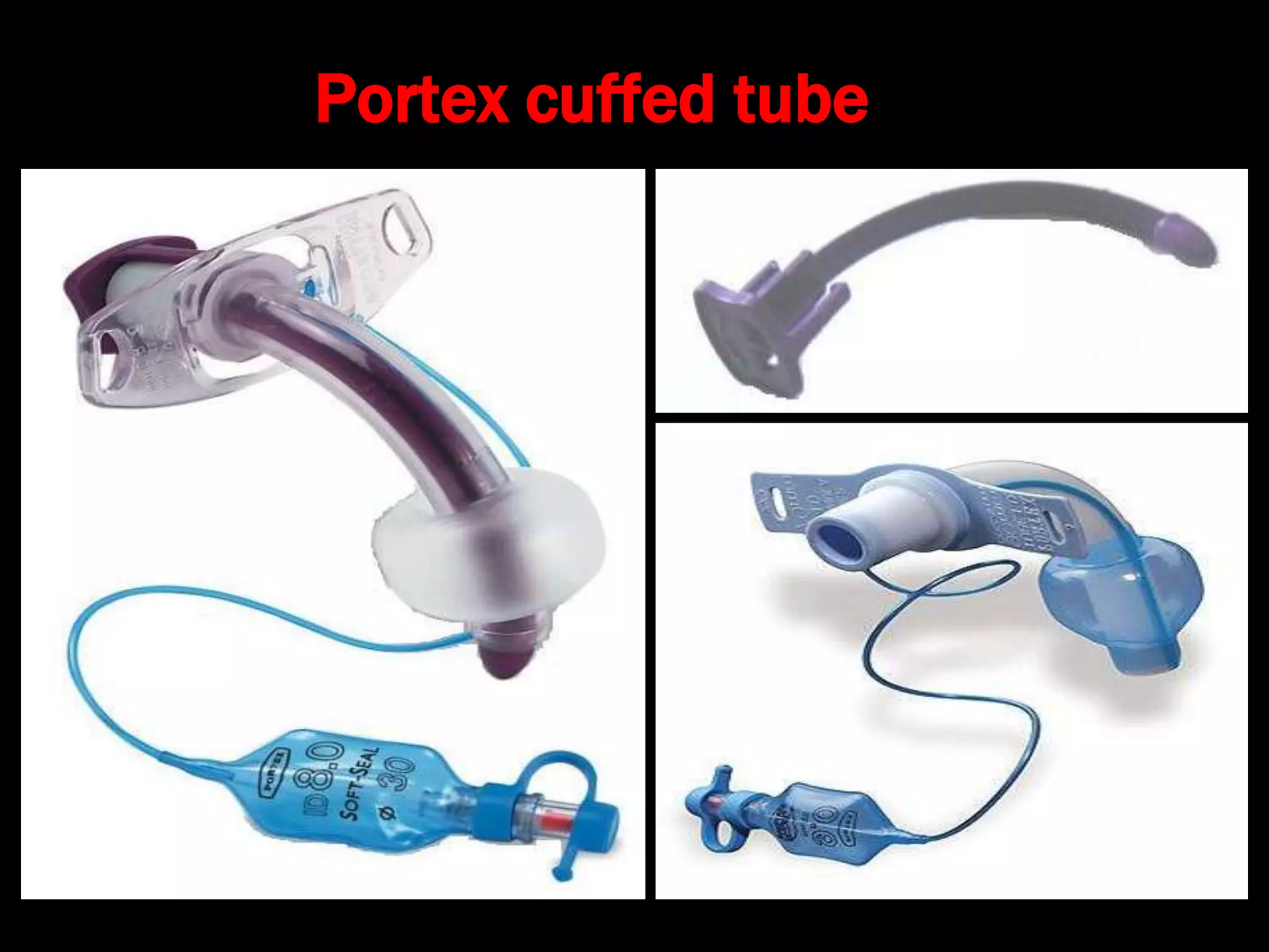 Tracheostomy: History, definition, indications, procedure ...
