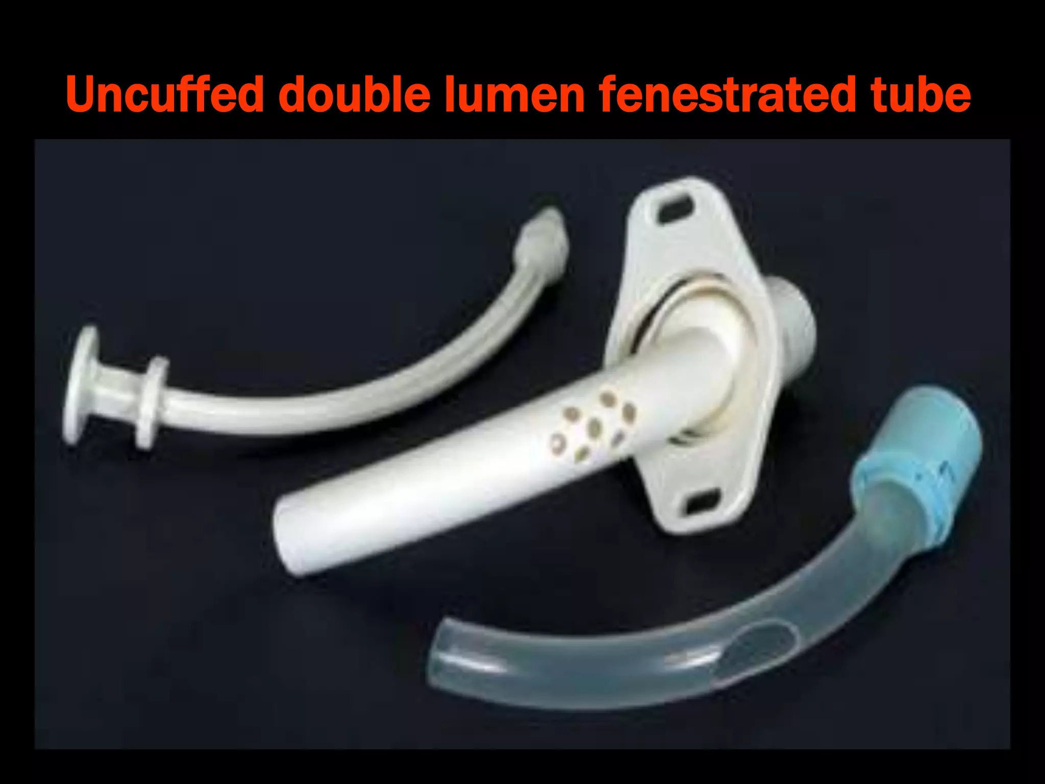 Tracheostomy: History, definition, indications, procedure ...