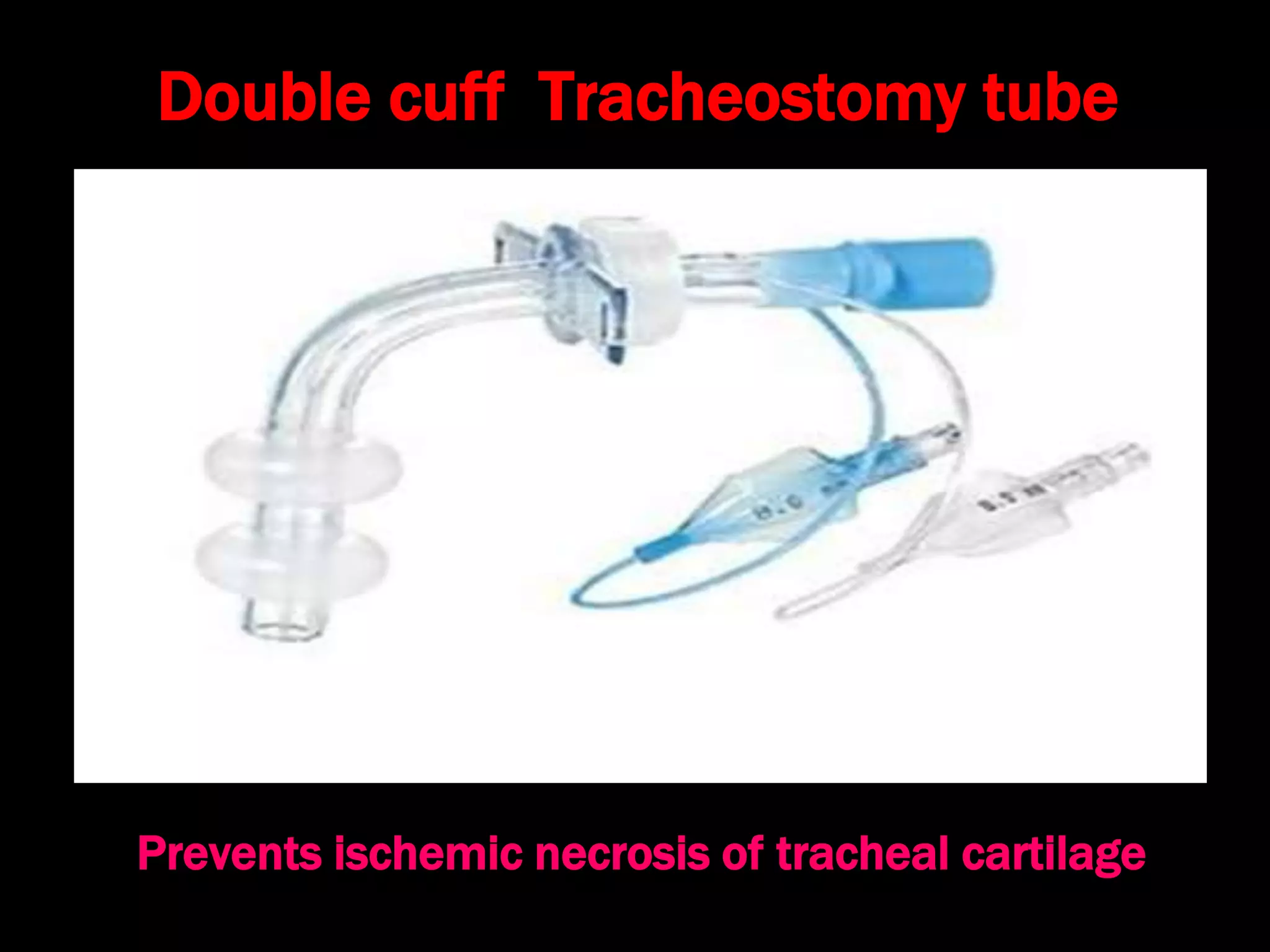 Tracheostomy: History, definition, indications, procedure ...