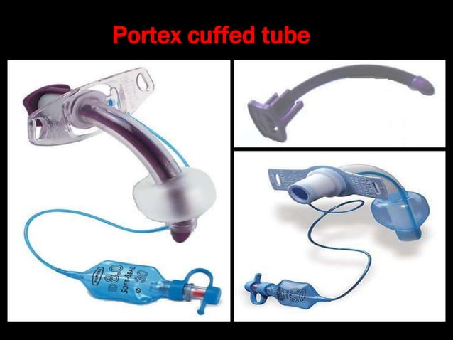 Tracheostomy: History, definition, indications, procedure ...