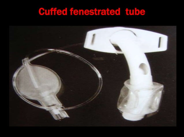 Tracheostomy: History, definition, indications, procedure ...