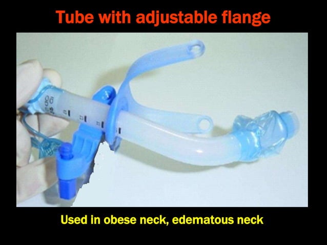 Tracheostomy: History, definition, indications, procedure ...