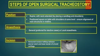 Tracheostomy | PPTX
