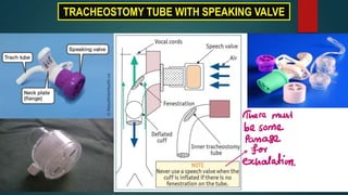 Tracheostomy | PPTX