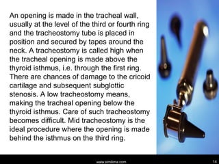 TRACHEOSTOMY.pdf
