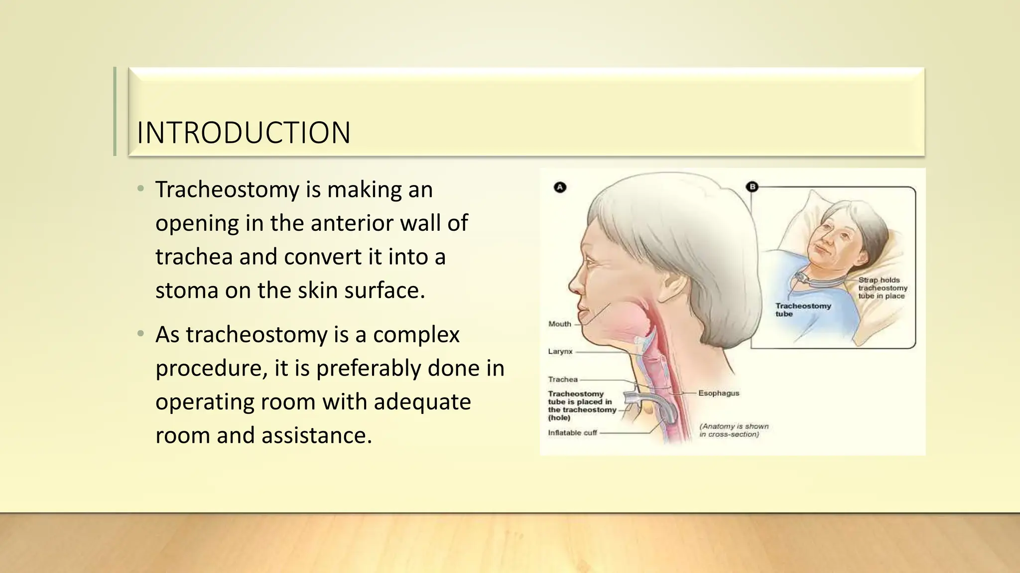 Tracheostomy procedure with indications.pptx