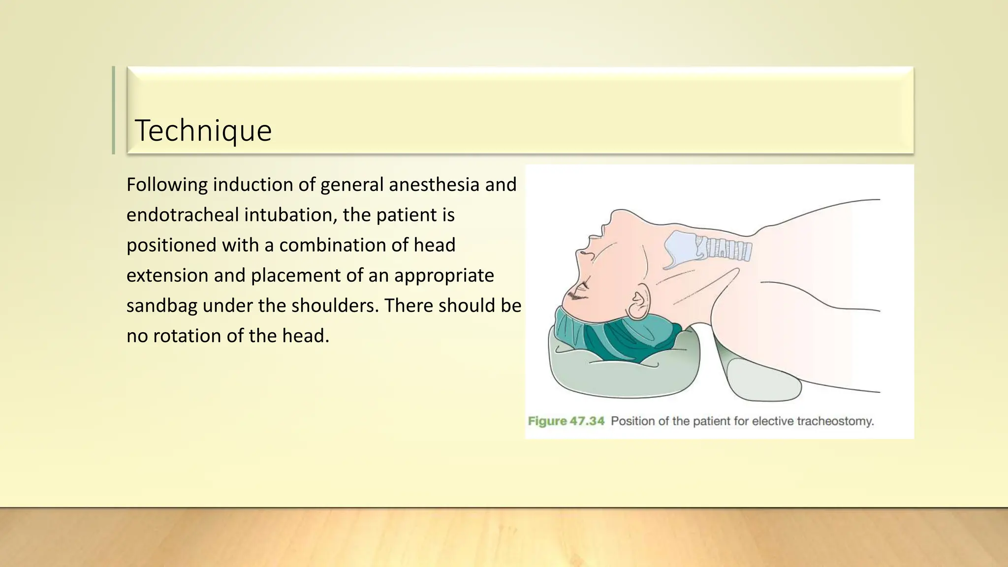 Tracheostomy procedure with indications.pptx
