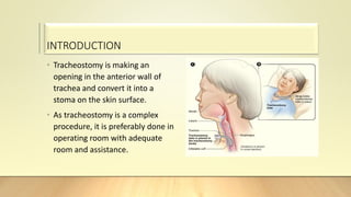 Tracheostomy procedure with indications.pptx