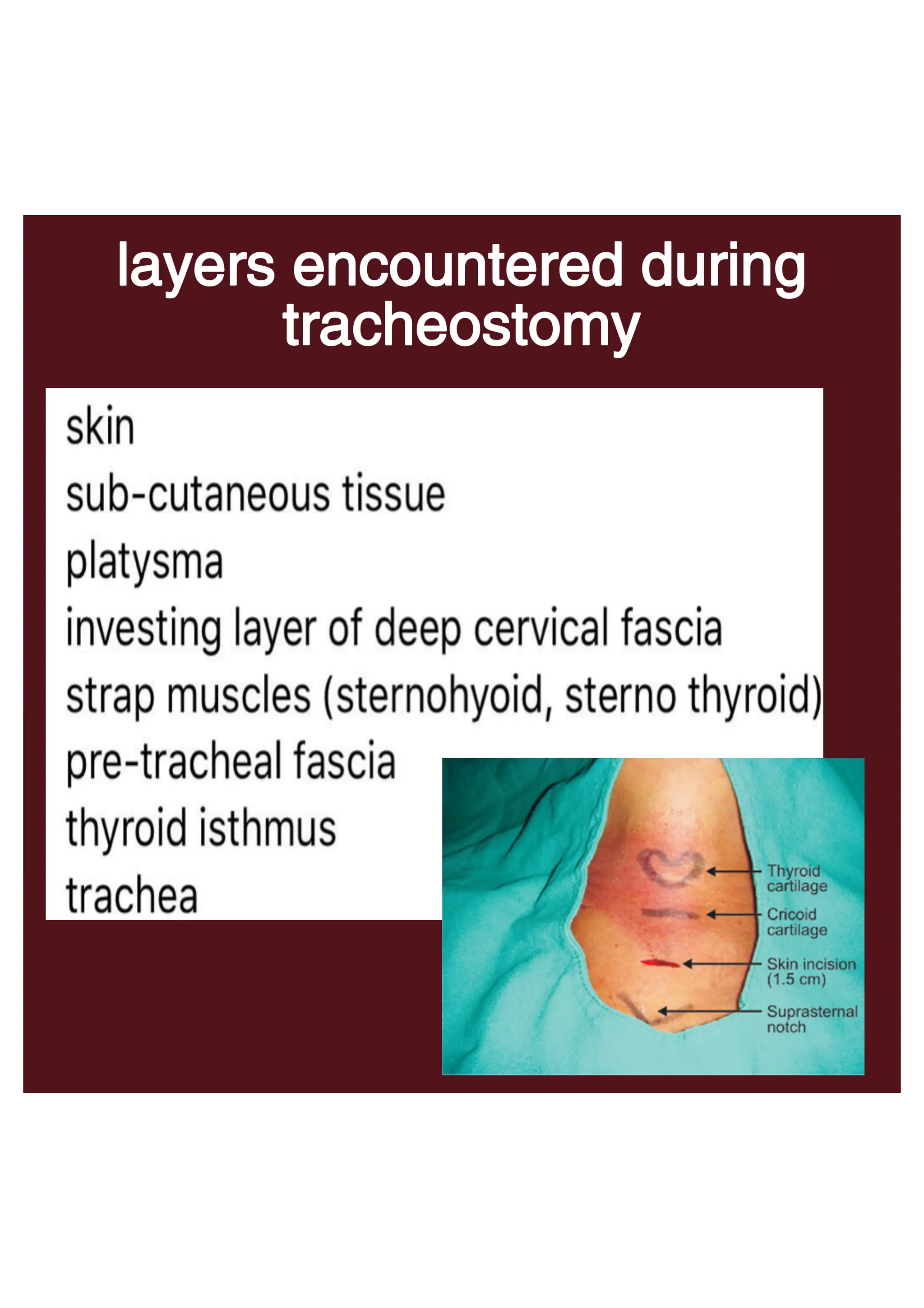 Tracheostomy .pdf ENT by QuickMedTALK. getting things done on time | PDF