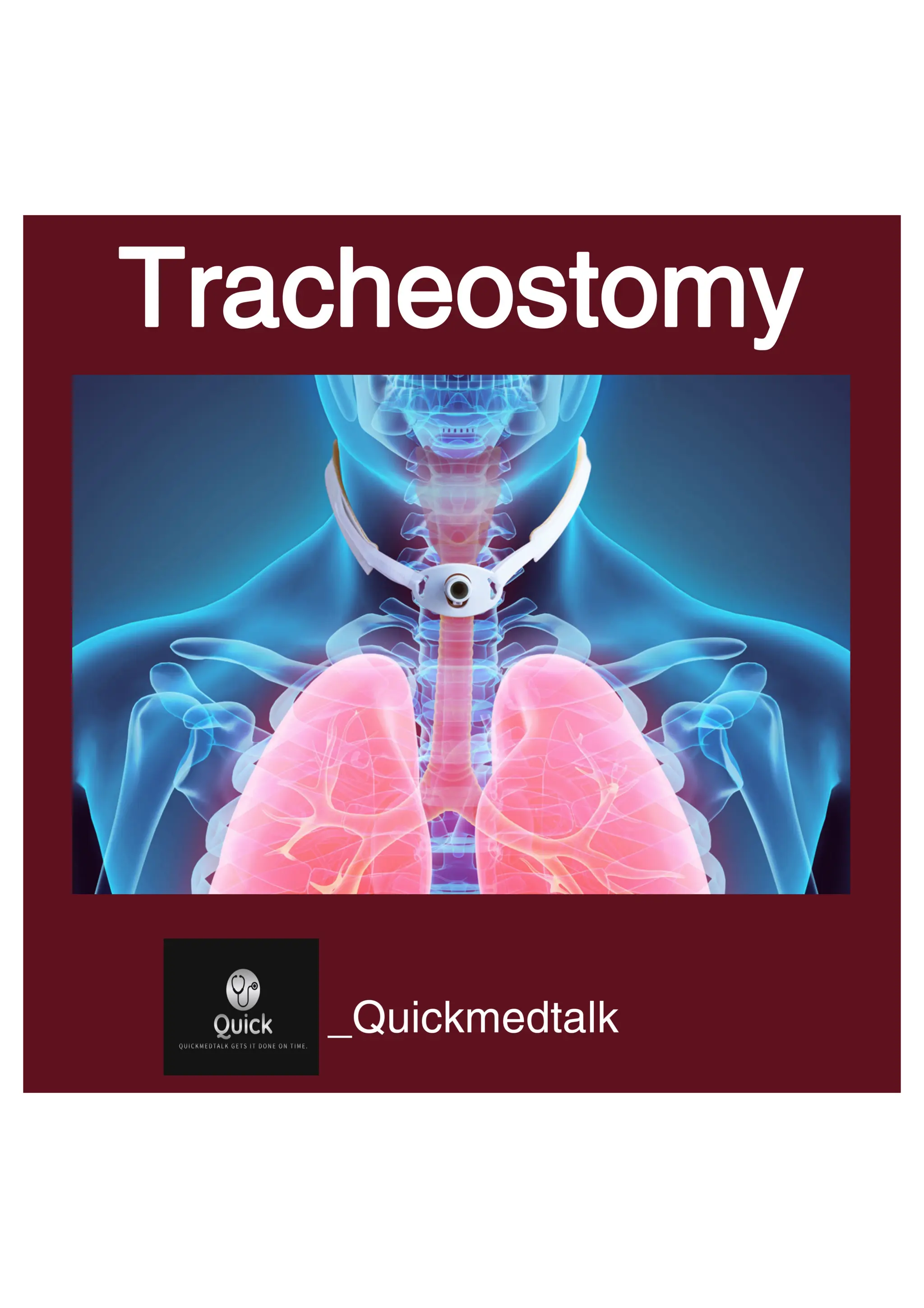 Tracheostomy .pdf ENT by QuickMedTALK. getting things done on time | PDF