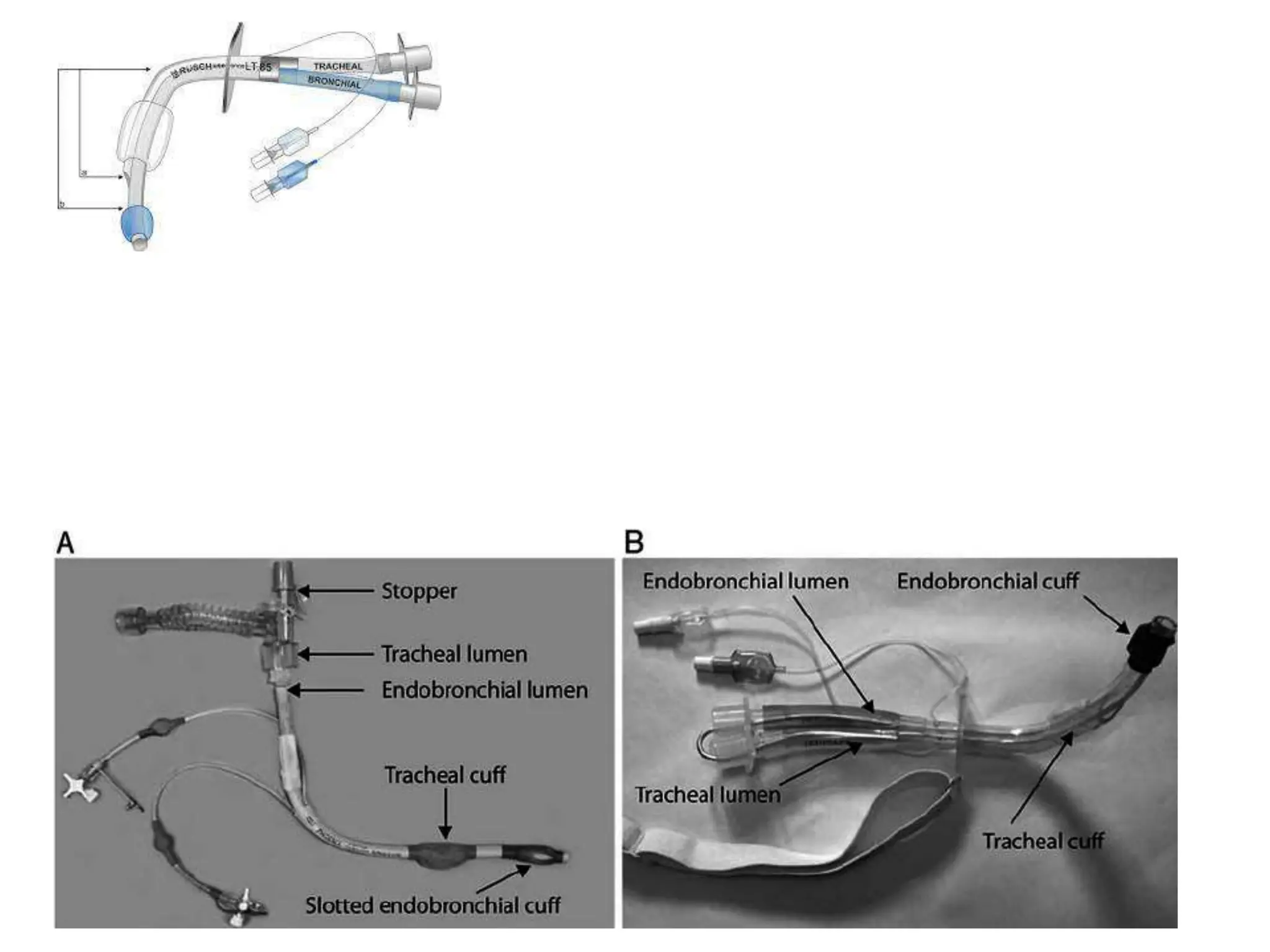 tracheostomy.pptx,....................... | PPTX