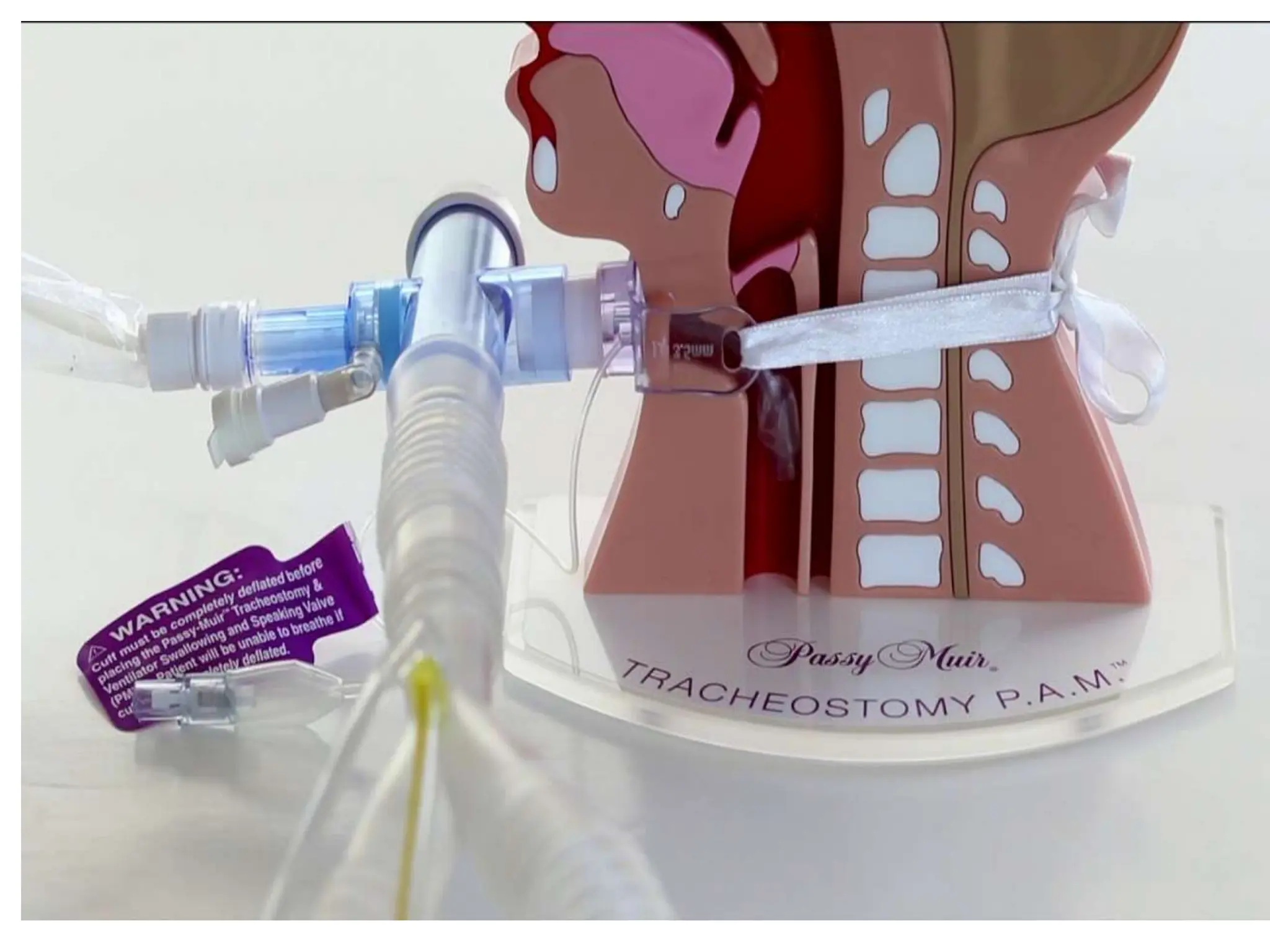 tracheostomy.pptx,....................... | PPTX