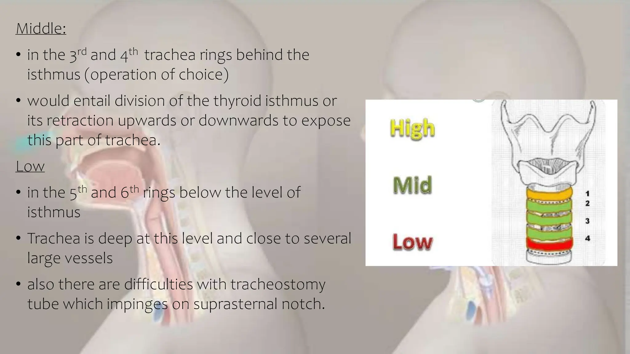 "Tracheostomy" Seminar for oral and maxillofacial surgery postgraduates ...