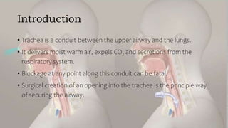 "Tracheostomy" Seminar for oral and maxillofacial surgery postgraduates ...