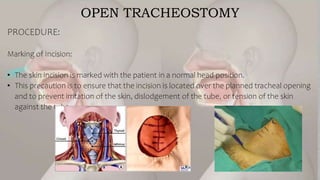 "Tracheostomy" Seminar for oral and maxillofacial surgery postgraduates ...