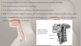 "Tracheostomy" Seminar for oral and maxillofacial surgery postgraduates ...