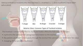 "Tracheostomy" Seminar for oral and maxillofacial surgery postgraduates ...