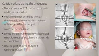 "Tracheostomy" Seminar for oral and maxillofacial surgery postgraduates ...