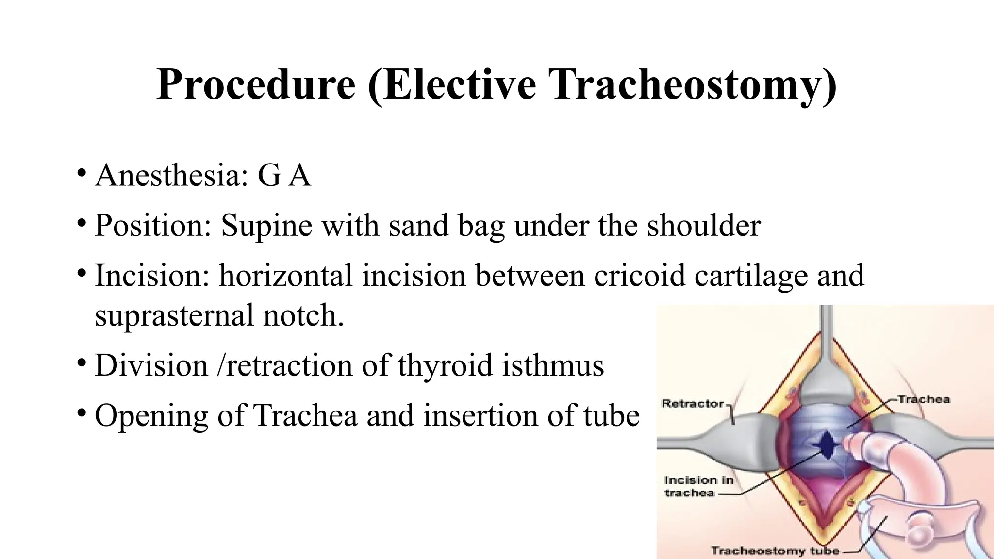 PRESENTATION ON TRACHEOSTOMY And physiotherapy management .pptx