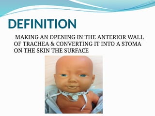 TRACHEOSTOMY and related procedures.pptx